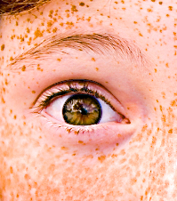 What is sodium fluorescein really staining? New insights from corneal ...