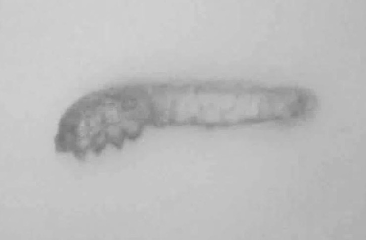Managing Demodex in clinical practice | Contact Lens Update