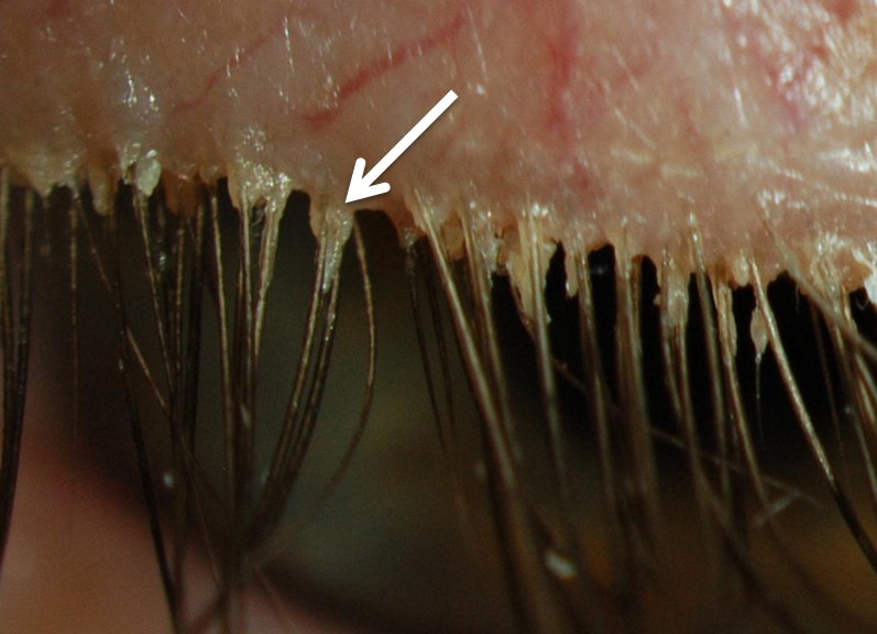 Everything you wanted to know and were afraid to ask about Demodex ...