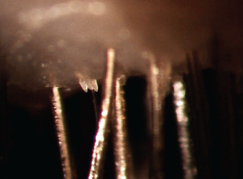 Managing Demodex in clinical practice | Contact Lens Update