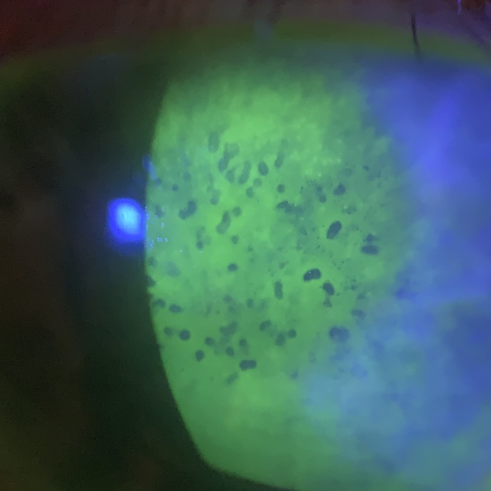 Troubleshooting scleral lens cases for improved performance | Contact ...